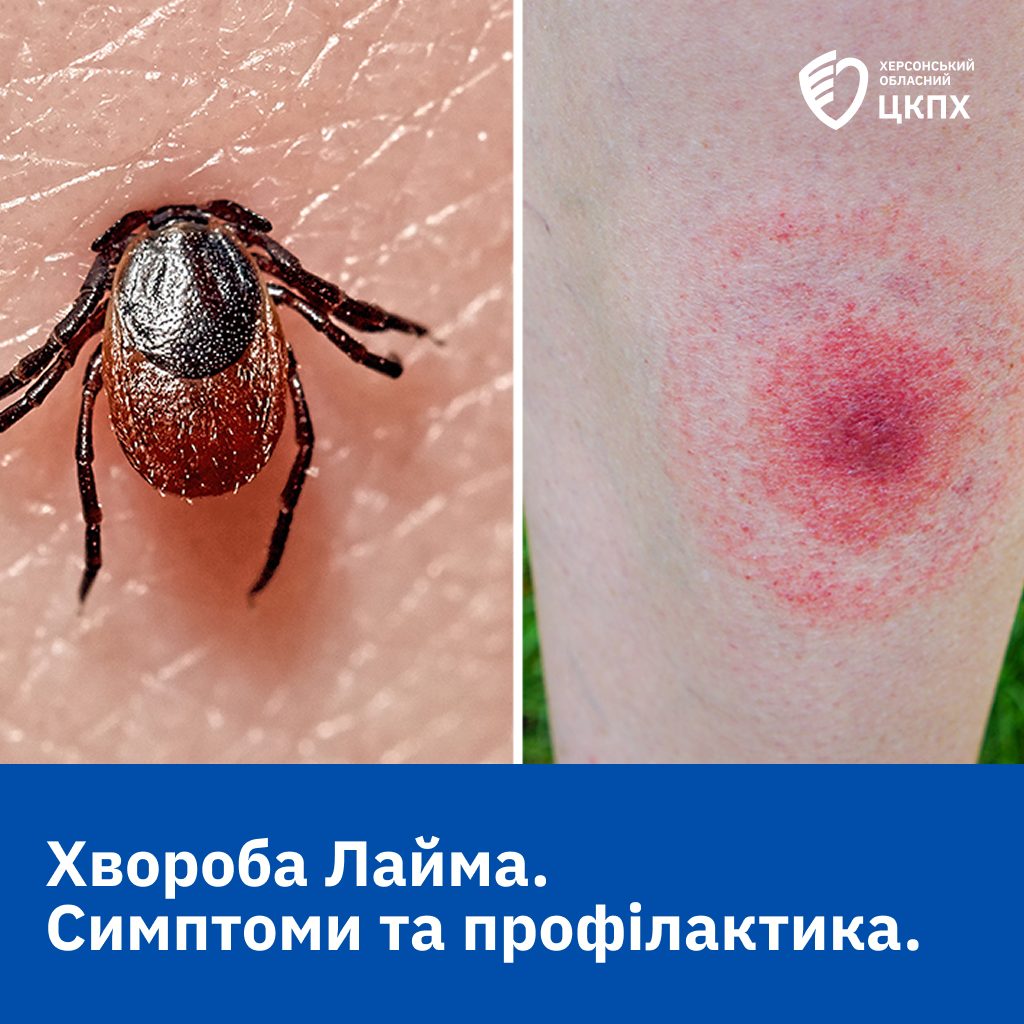 Хвороба Лайма. Симптоми та профілактика. - Новини - Херсонський ...